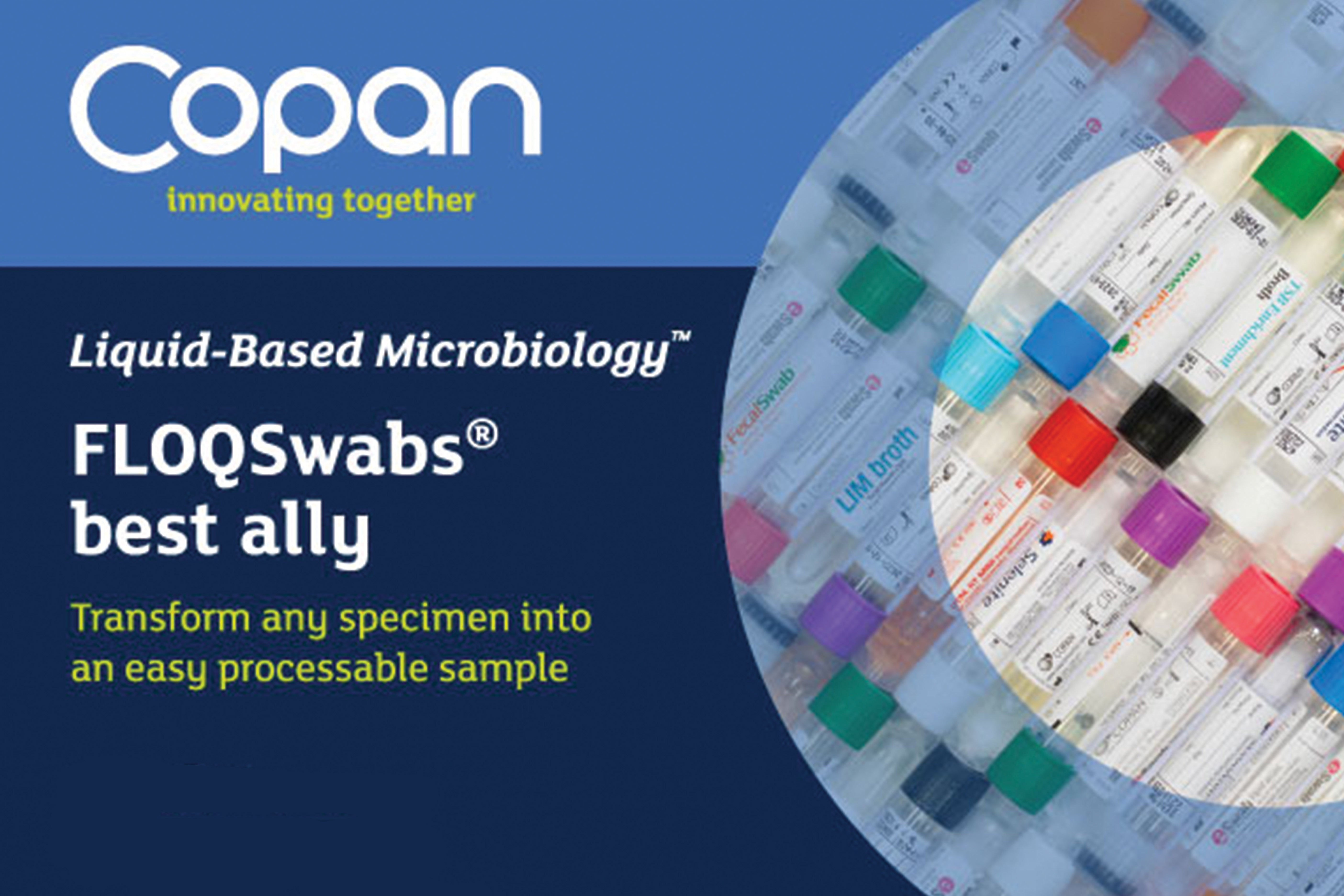 Scientific Insights: Copan FLOQSwabs® Yield Superior Flu Diagnostics a